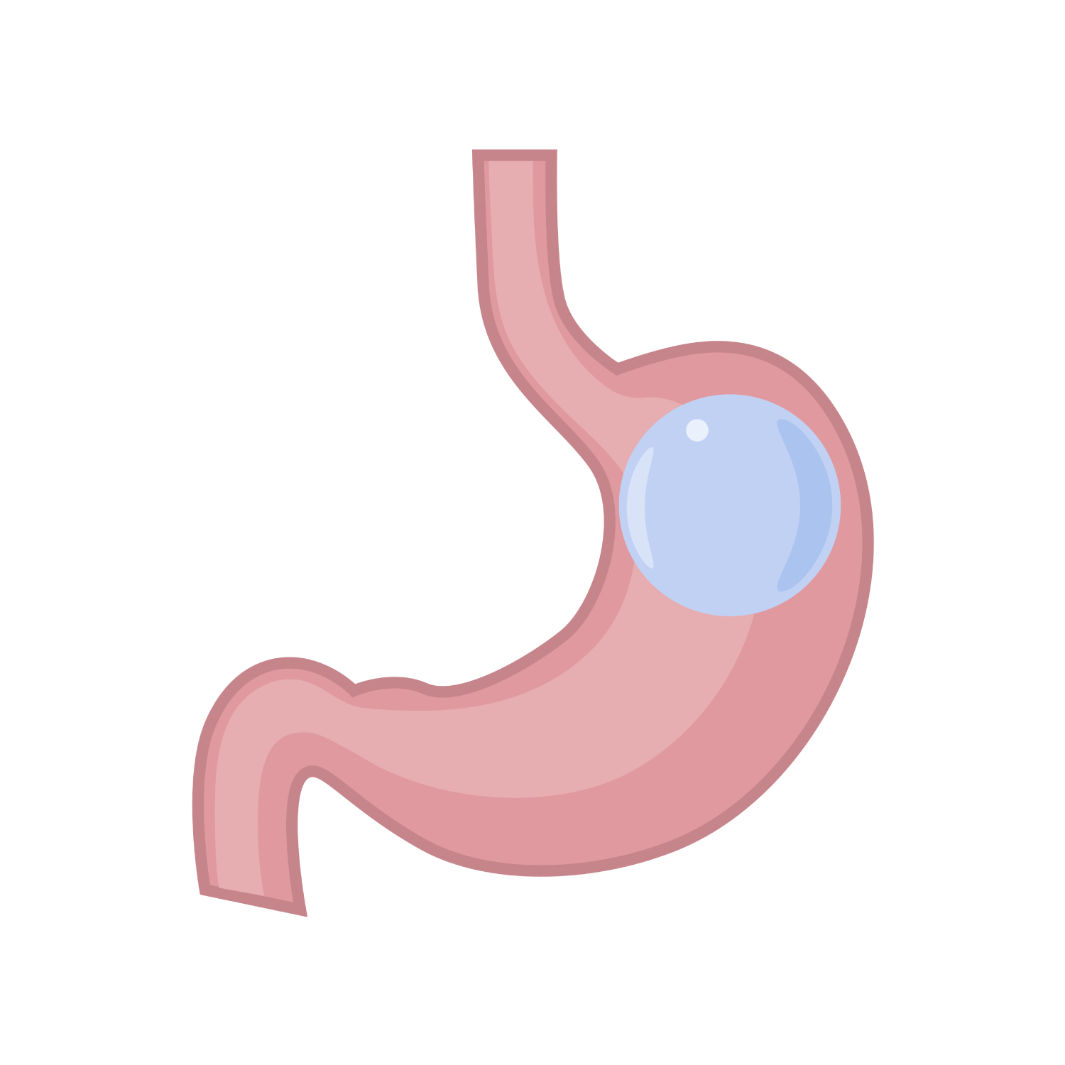 Endoscopic Gastric Balloon – Safe Booking Surgery
